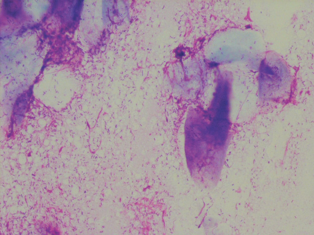 Superficial Pyoderma in Dogs: Clinical Overview & Diagnosis